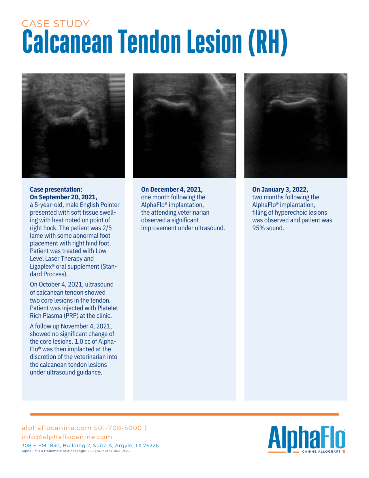 Calcanean Tendon Lesion (RH) - AlphaFlo