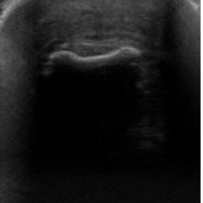 Supportive Care for Canine Calcanean Tendon Lesions | AlphaFlo